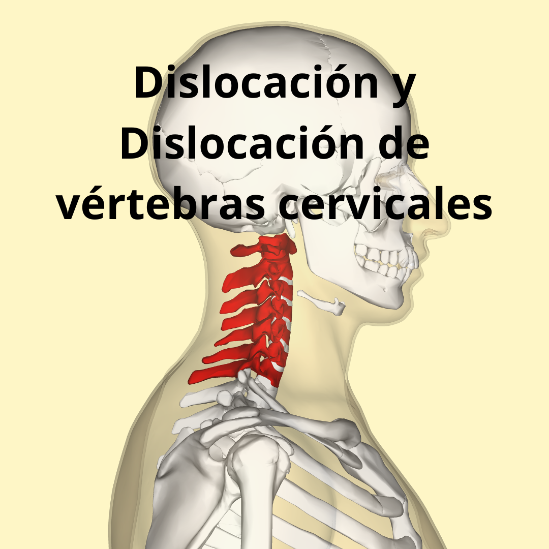 Dislocación – Dislocación de vértebras cervicales | Mi Encuentro Conmigo